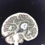 Medulla Oblongata Damage - Signs And Effects on Your Health