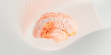 Understanding Slow Brain Waves and Their Symptoms